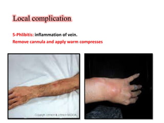 IV Cannulation | PPTX
