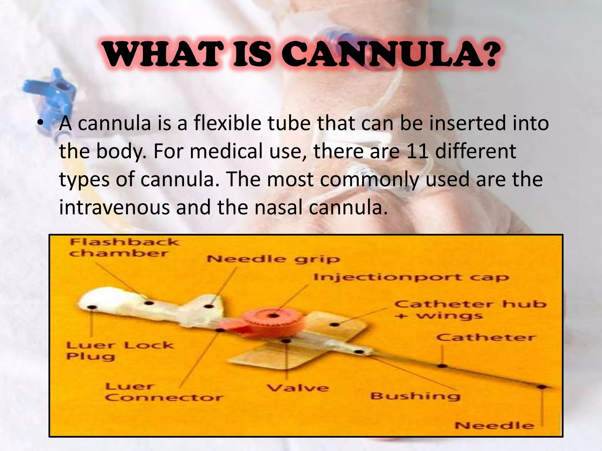 20 iv cannulation | PPTX