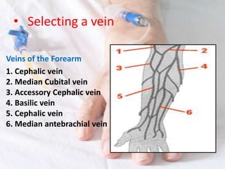 20 iv cannulation | PPTX