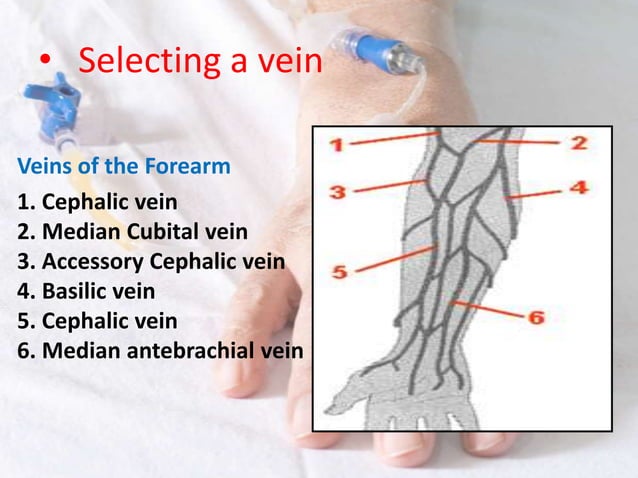 20 iv cannulation | PPTX | Blood Disorders | Diseases and Conditions
