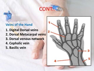 20 iv cannulation | PPTX