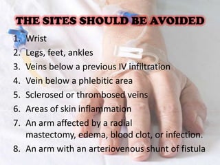 20 iv cannulation | PPTX