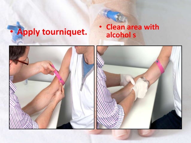 20 iv cannulation | PPTX | Blood Disorders | Diseases and Conditions