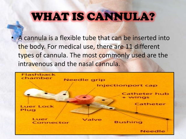 20 iv cannulation | PPTX | Blood Disorders | Diseases and Conditions