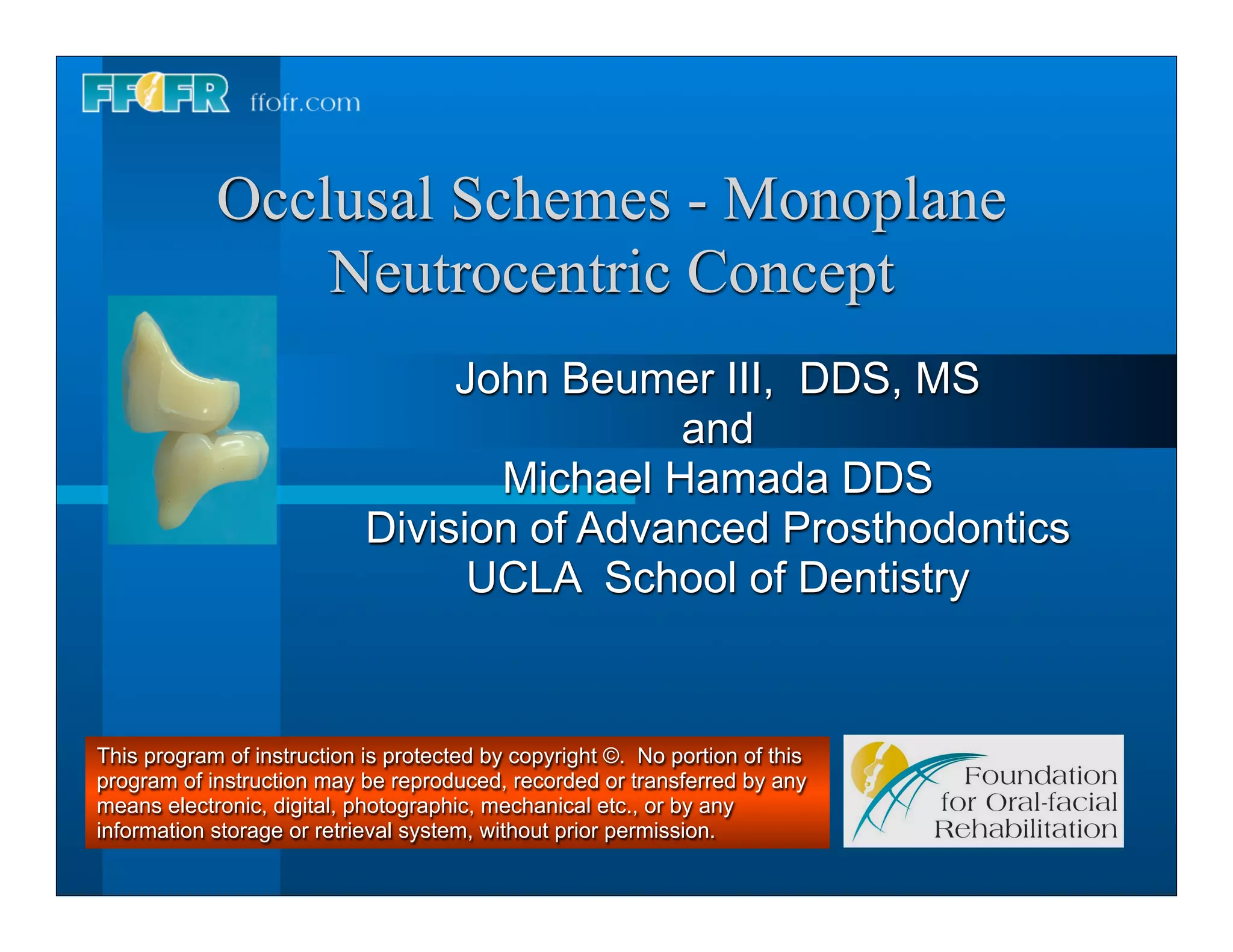 20.(new)occlusal schemes monoplane-neutrocentric concept | PDF