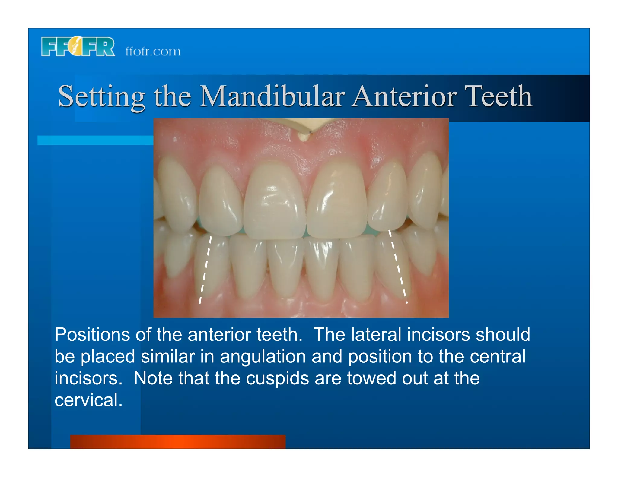 20.(new)occlusal schemes monoplane-neutrocentric concept | PDF