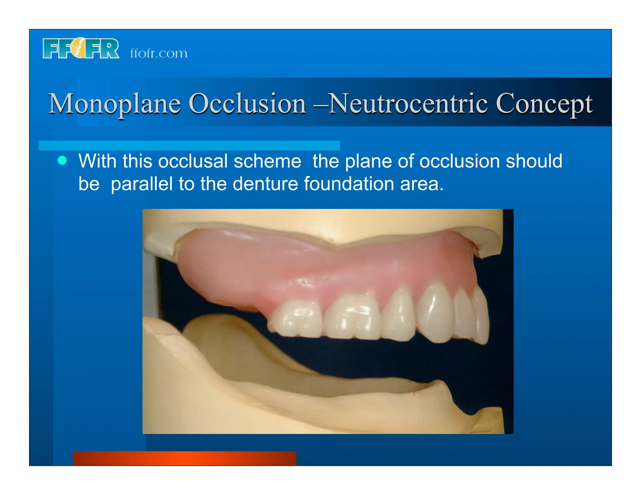 20.(new)occlusal schemes monoplane-neutrocentric concept | PDF