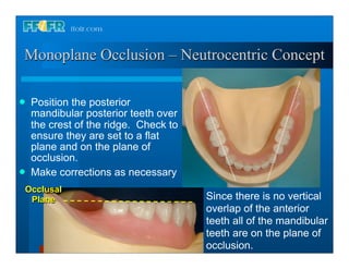 20.(new)occlusal schemes monoplane-neutrocentric concept | PDF