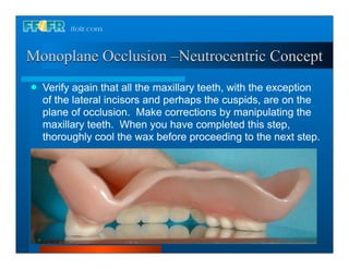 20.(new)occlusal schemes monoplane-neutrocentric concept | PDF