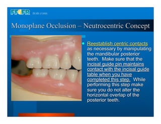 20.(new)occlusal schemes monoplane-neutrocentric concept | PDF