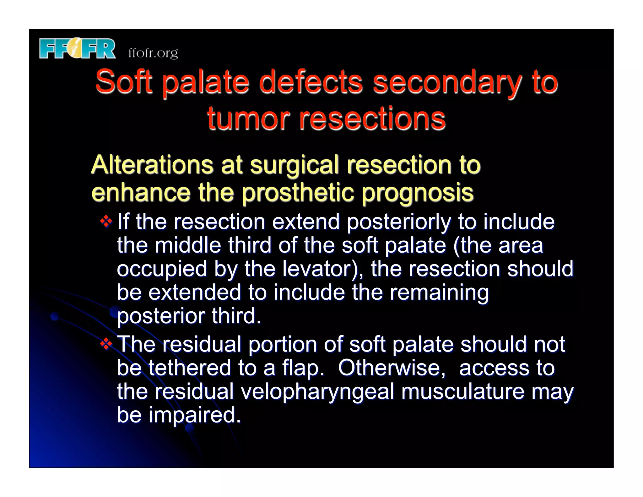 20. (new)restoration of soft palate defects | PDF