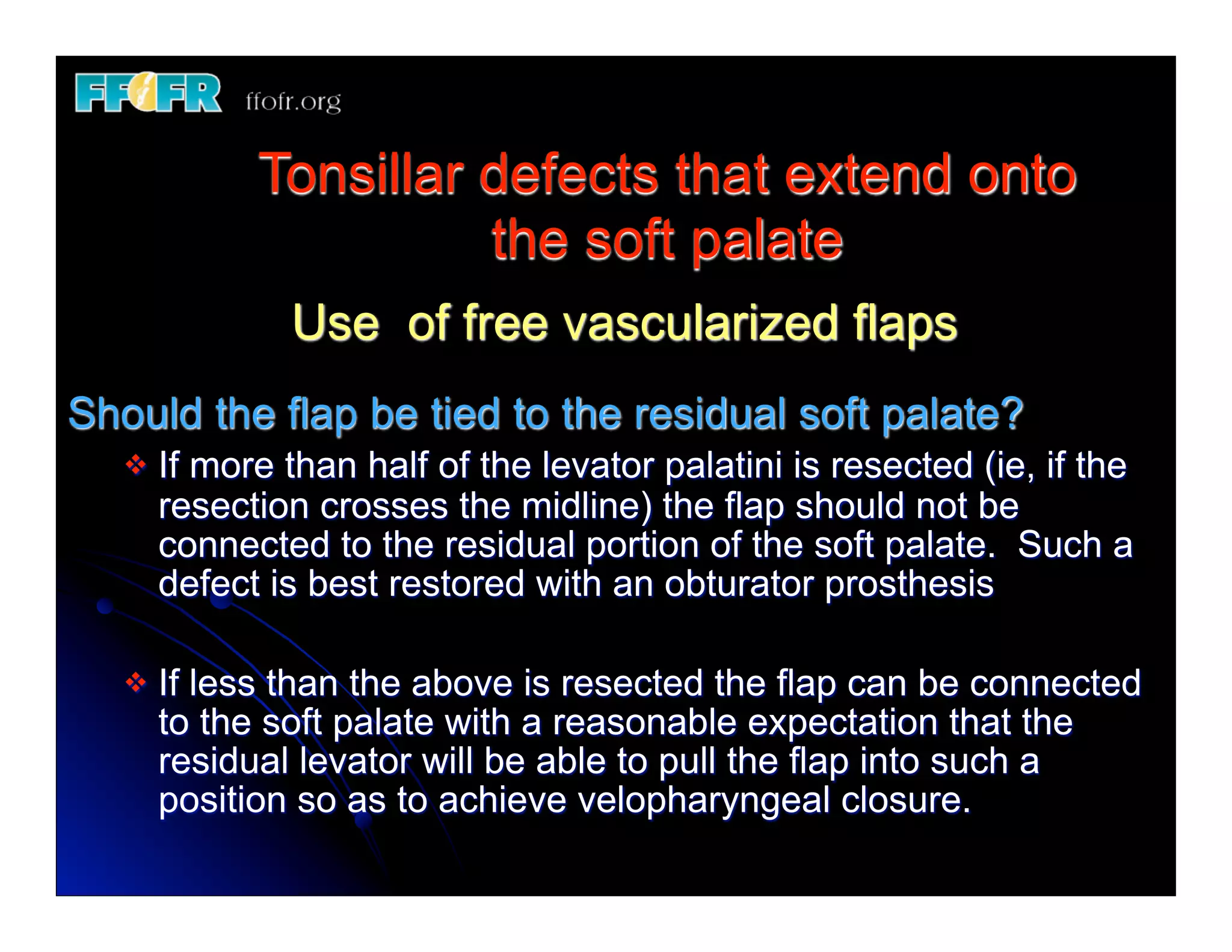 20. (new)restoration of soft palate defects | PDF