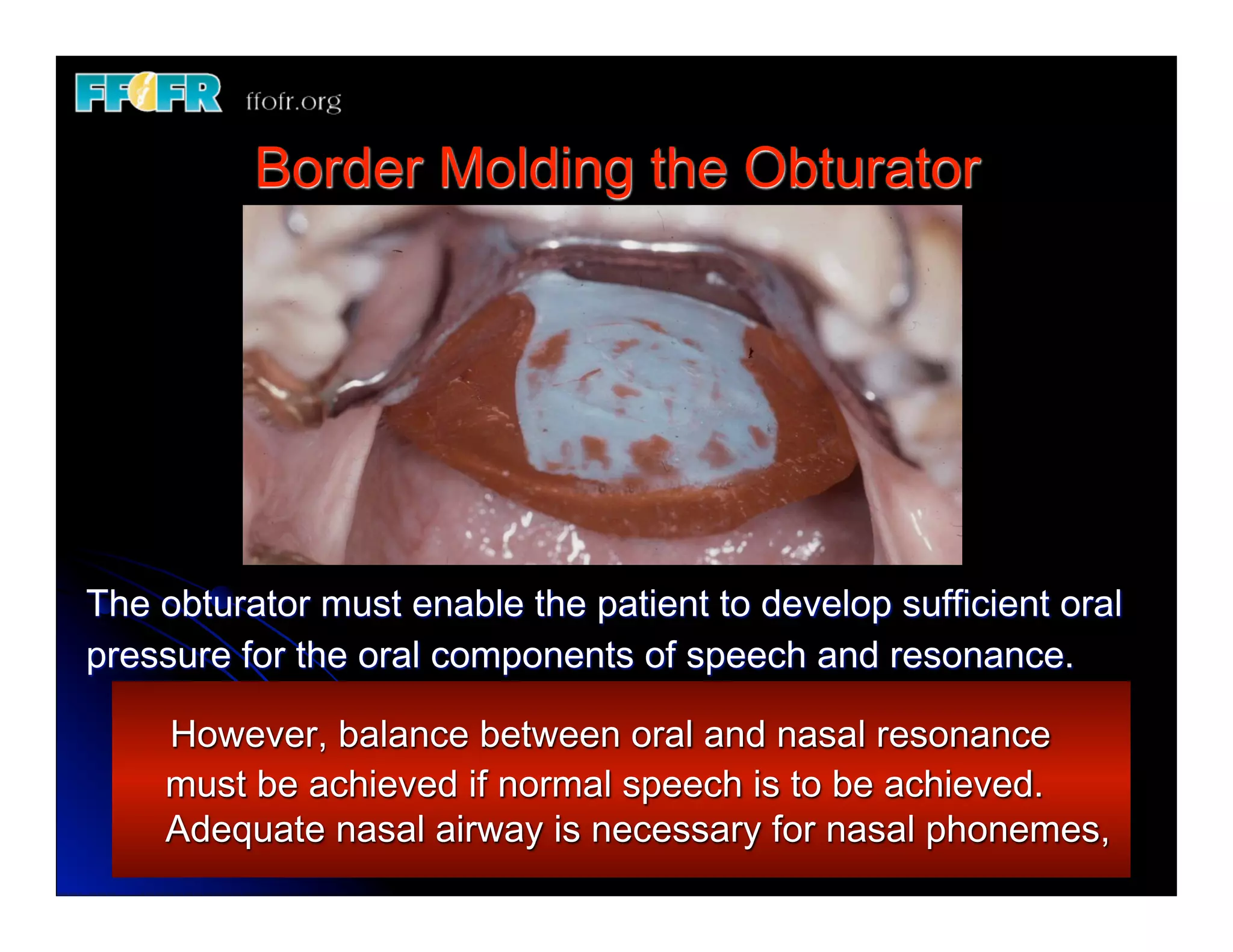 20. (new)restoration of soft palate defects | PDF