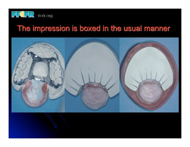 20. (new)restoration of soft palate defects | PDF | Ear, Nose and ...