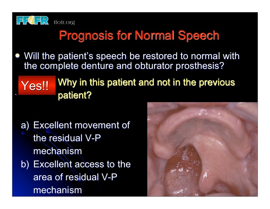 20. (new)restoration of soft palate defects