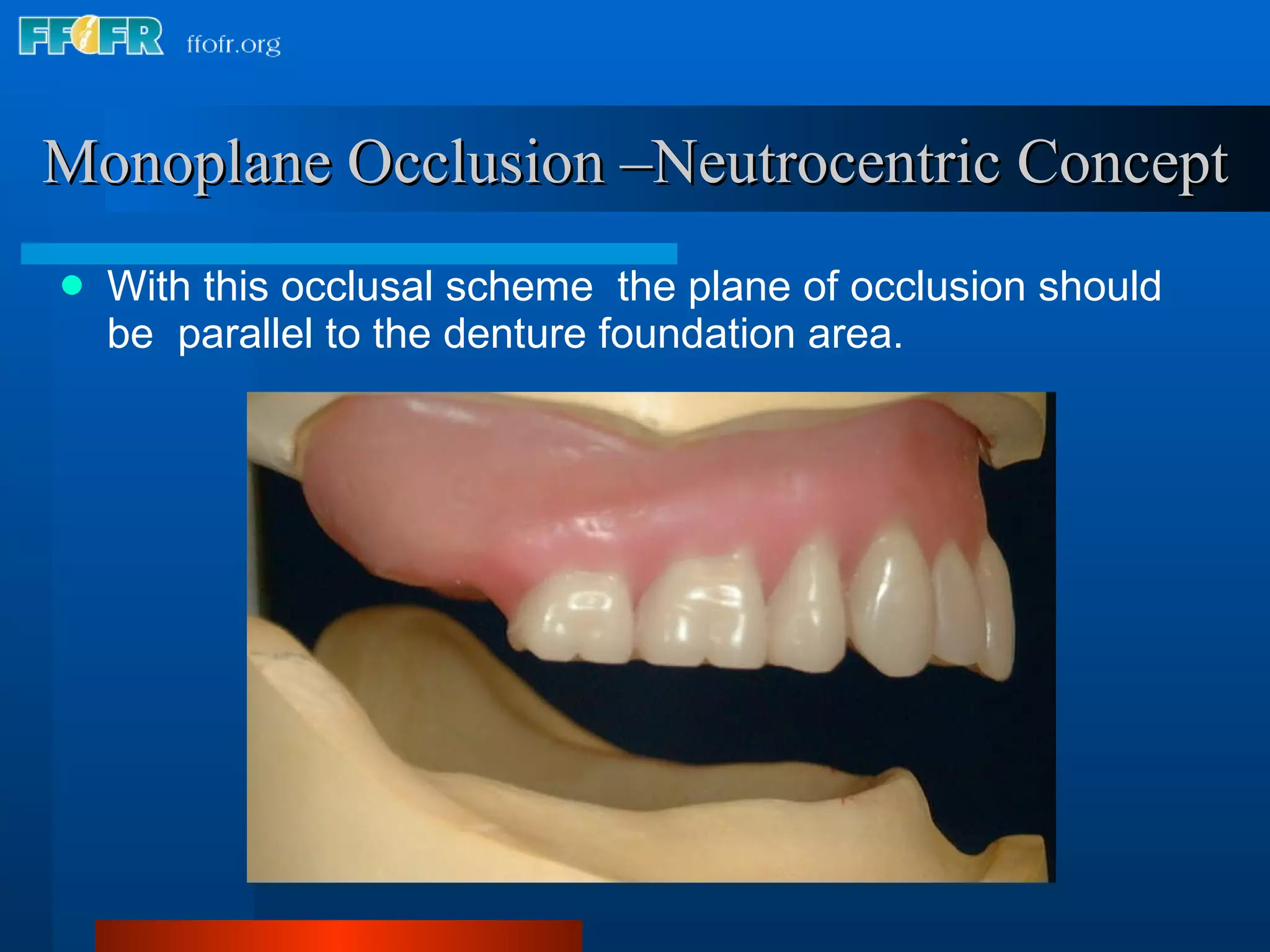 20.occlusal schemes monoplane-neutrocentric concept | PPT