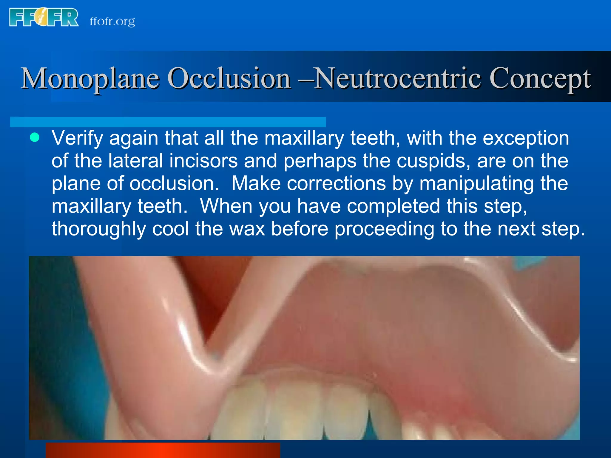 20.occlusal schemes monoplane-neutrocentric concept | PPT