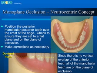 20.occlusal schemes monoplane-neutrocentric concept | PPT
