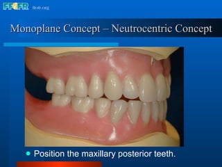 20.occlusal schemes monoplane-neutrocentric concept | PPT