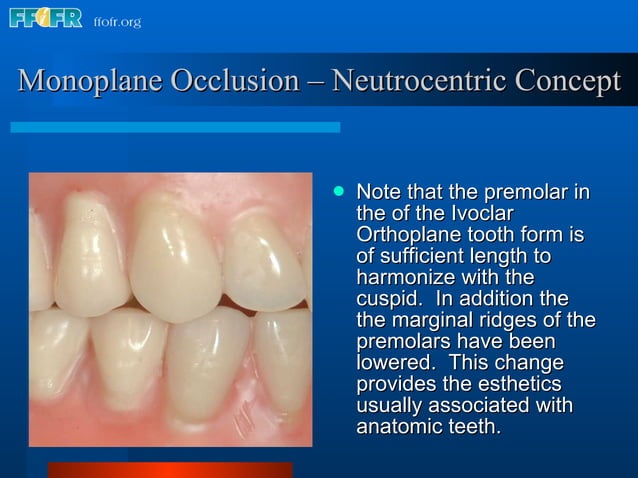 20.occlusal schemes monoplane-neutrocentric concept | PPT