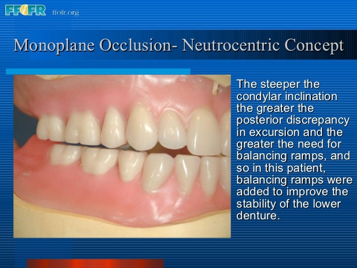 20.occlusal schemes monoplane-neutrocentric concept