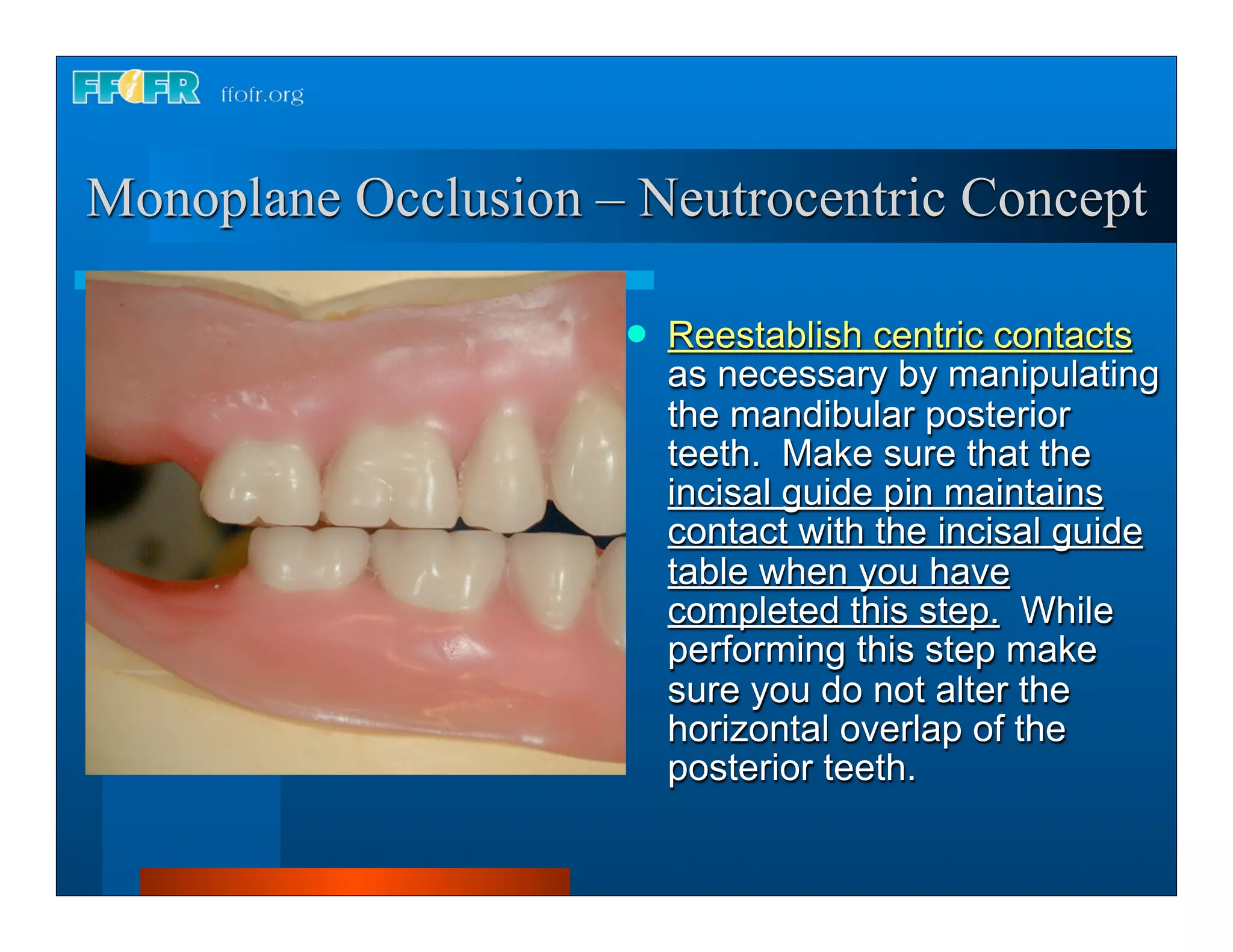 20.occlusal schemes monoplane-neutrocentric concept | PDF