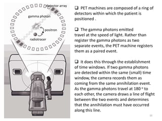 20.pet scan in oncology | PPTX