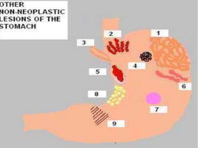 20- Stomach & duodenum for anatomy students | PPT | Free Download