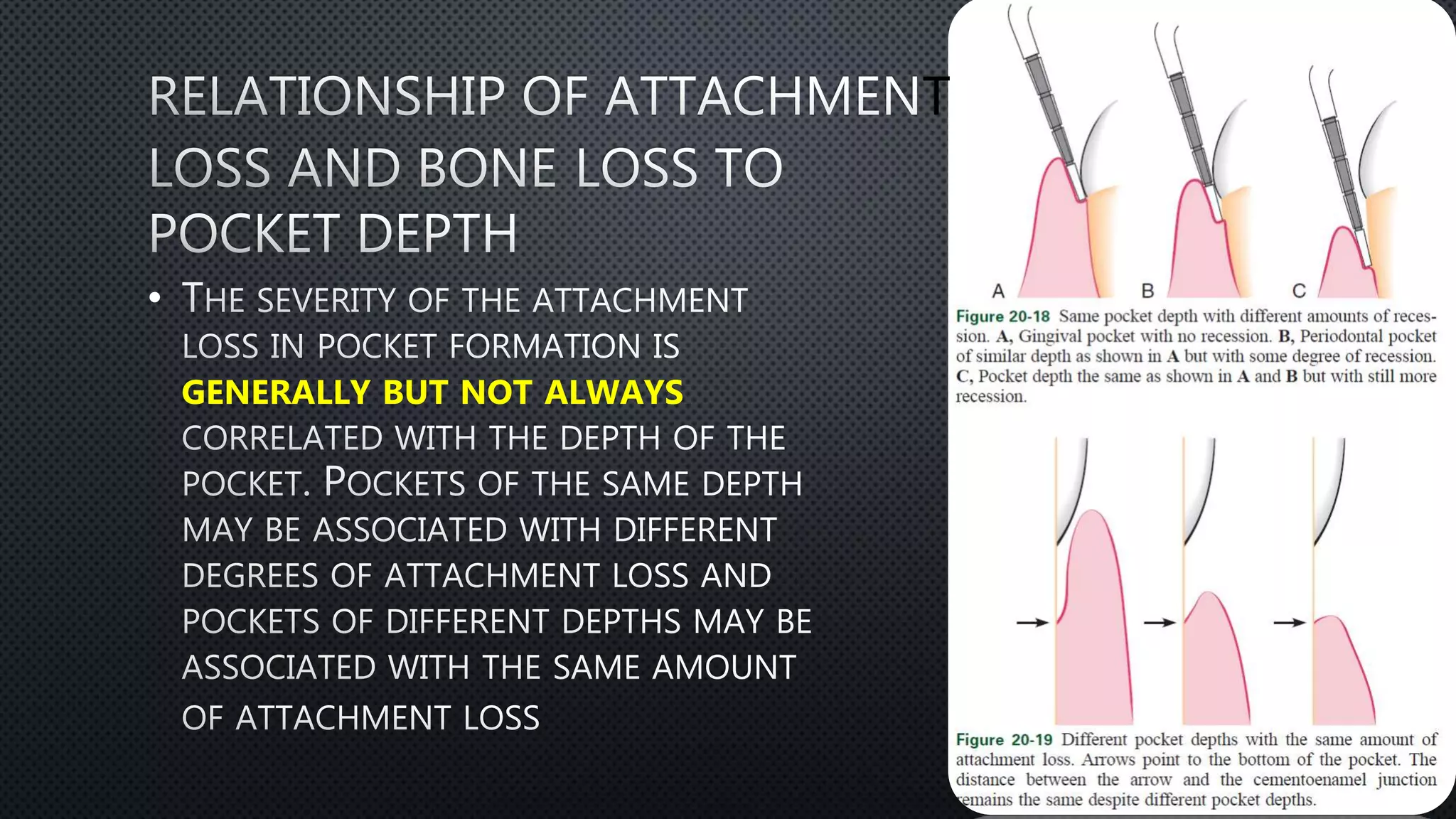 Carranza 2015, 12th edition, Chapter 20, The Periodontal Pocket | PPTX