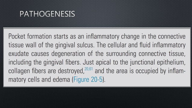 Carranza 2015, 12th edition, Chapter 20, The Periodontal Pocket | PPTX