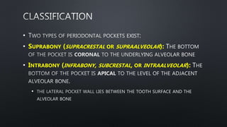 Carranza 2015, 12th edition, Chapter 20, The Periodontal Pocket | PPTX