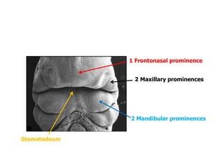 Development_of_face_palate (1).ppt