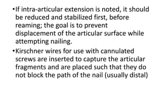 200330 Controversies in the intramedullary nailing of tibia | PPTX