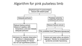 200331 Evolving concepts in treatment of supracondylar fractures in ...