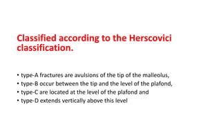 200403 Controversies in the management of ankle fractures | PPT