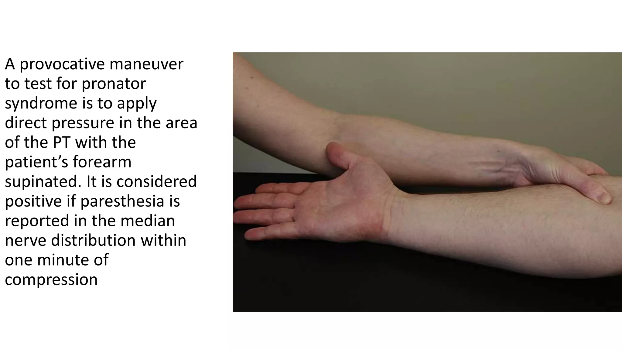 200426 Examination of compressive neuropathy of median nerve | PPT