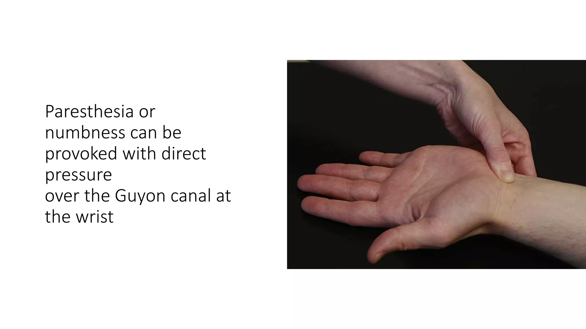 200427 Examination of compressive neuropathies of ulnar nerve | PPTX