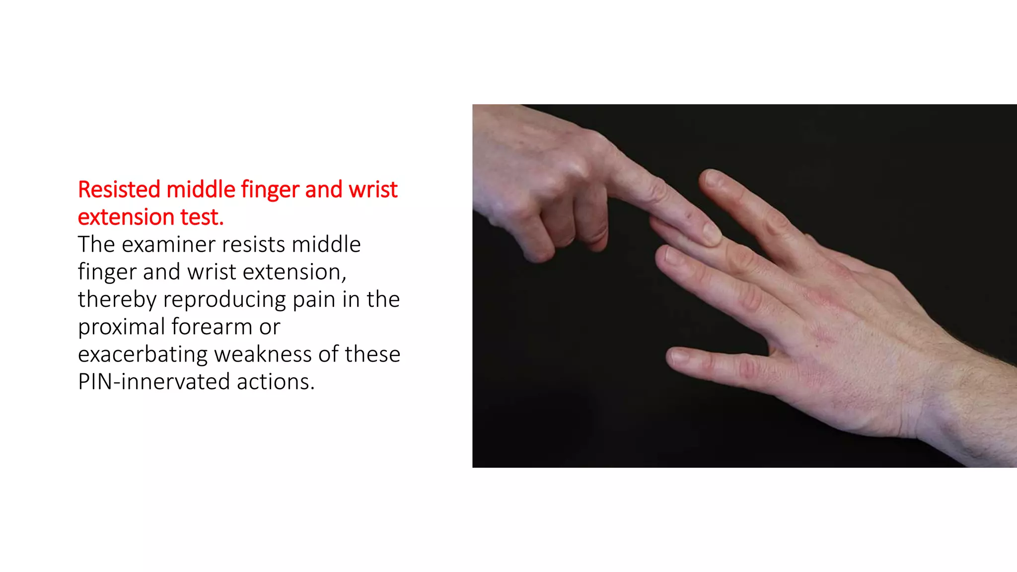 Examination in compressive neuropathies of the radial nerve | PPTX