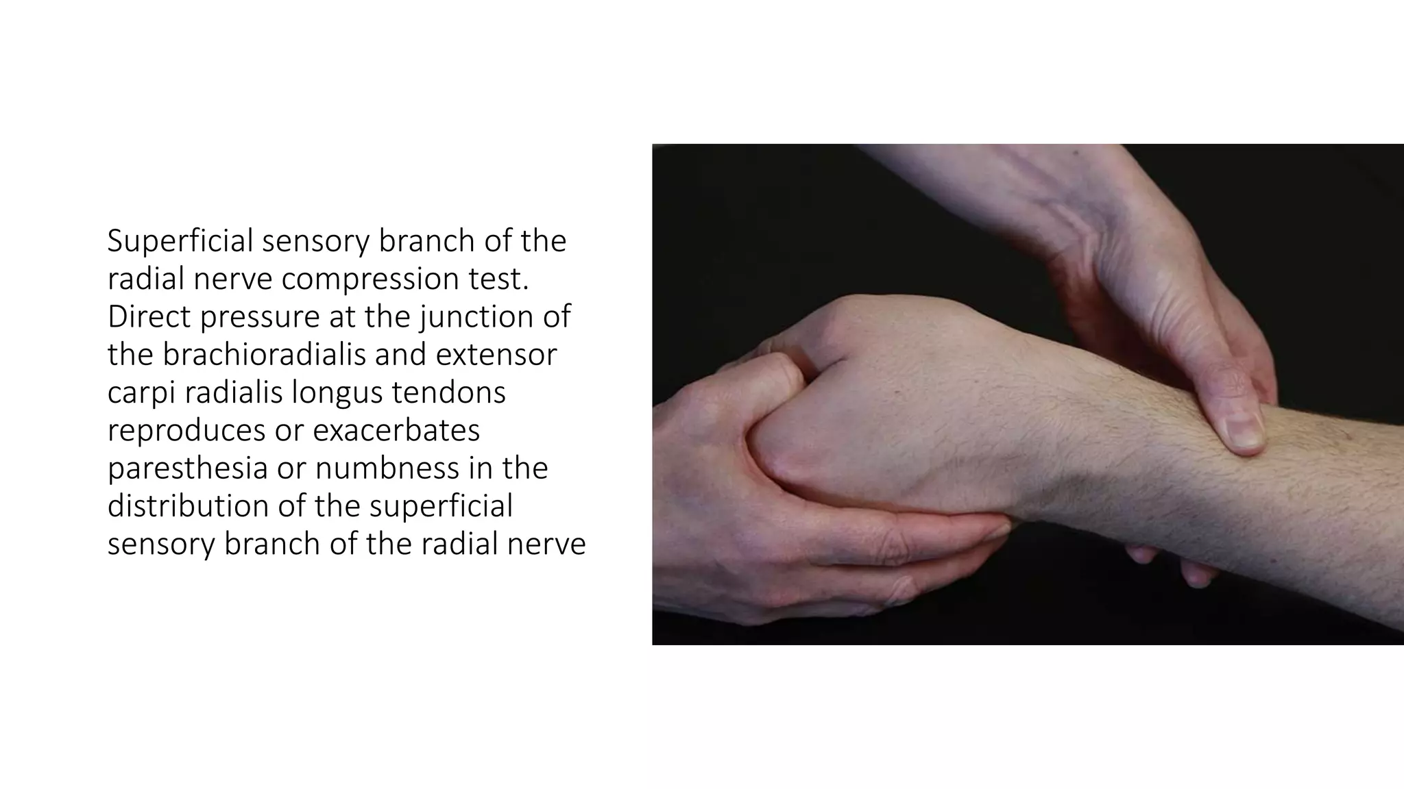 Examination in compressive neuropathies of the radial nerve | PPTX