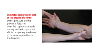Examination in compressive neuropathies of the radial nerve | PPTX