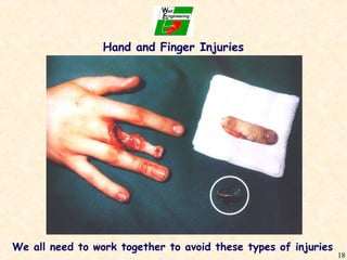 Hands & Fingers Injury Prevention Campaign.ppt