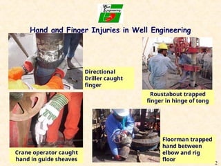 Hands & Fingers Injury Prevention Campaign.ppt