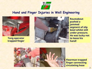 Hands & Fingers Injury Prevention Campaign.ppt