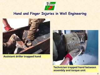 Hands & Fingers Injury Prevention Campaign.ppt