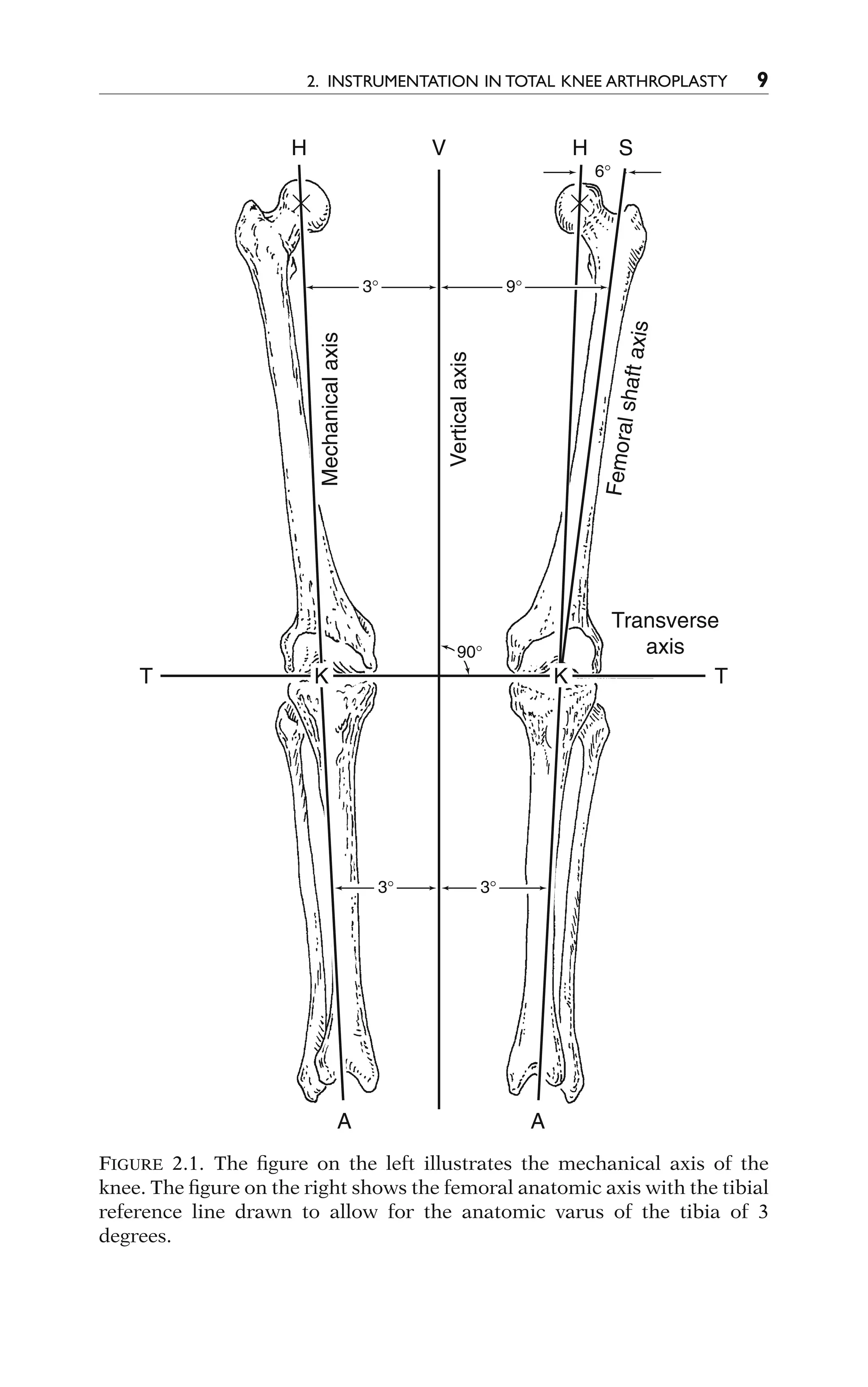 knee arthroplasty handbook | PDF
