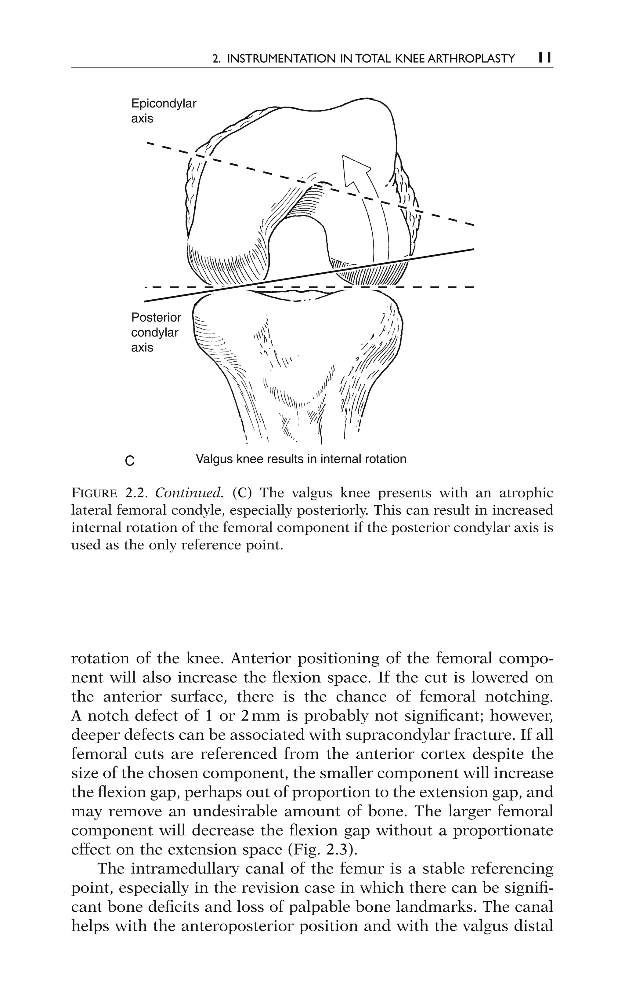 knee arthroplasty handbook | PDF