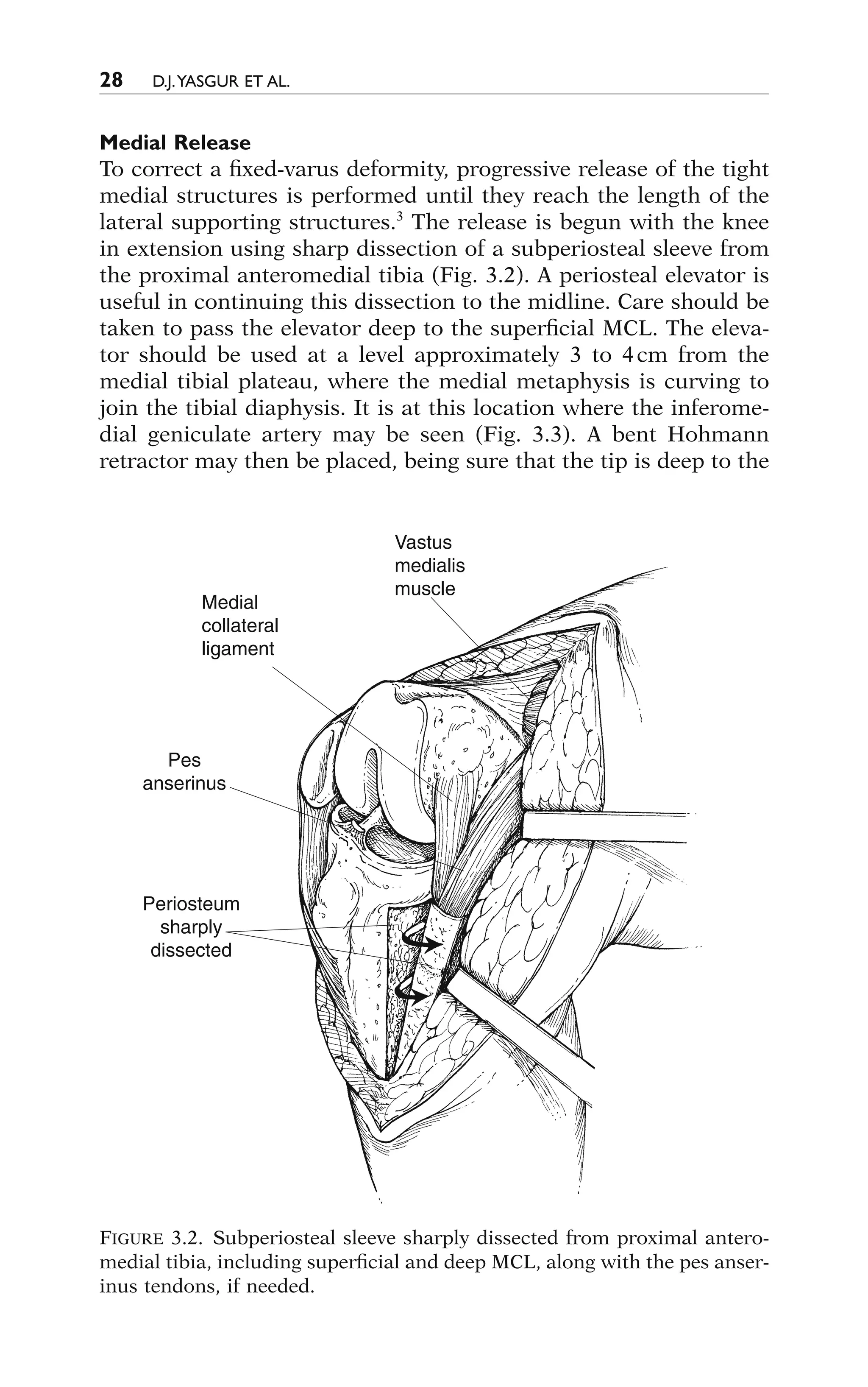 knee arthroplasty handbook | PDF