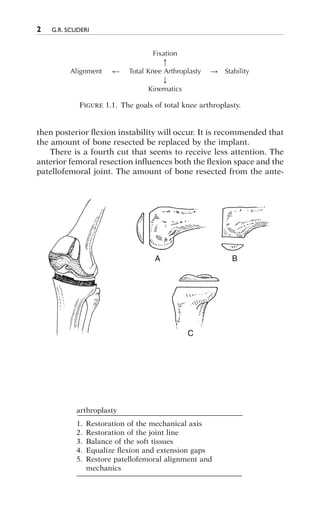 knee arthroplasty handbook | PDF