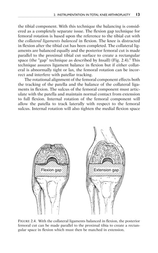knee arthroplasty handbook | PDF