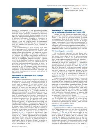 Rehabilitación de las lesiones tendinosas traumáticas de la mano | PDF